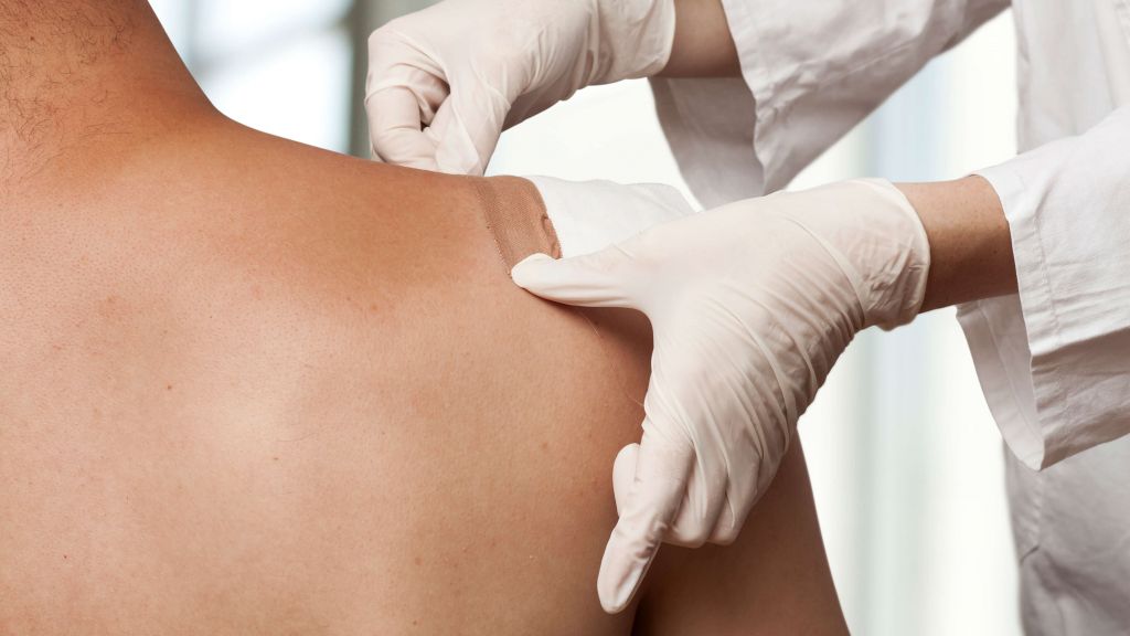 What Are The Different Types of Burns? - University Urgent Care